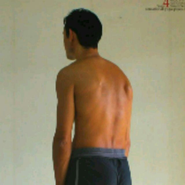 Bending the Ribcage Forwards and Backwards by Sungwook C. - Exercise ...